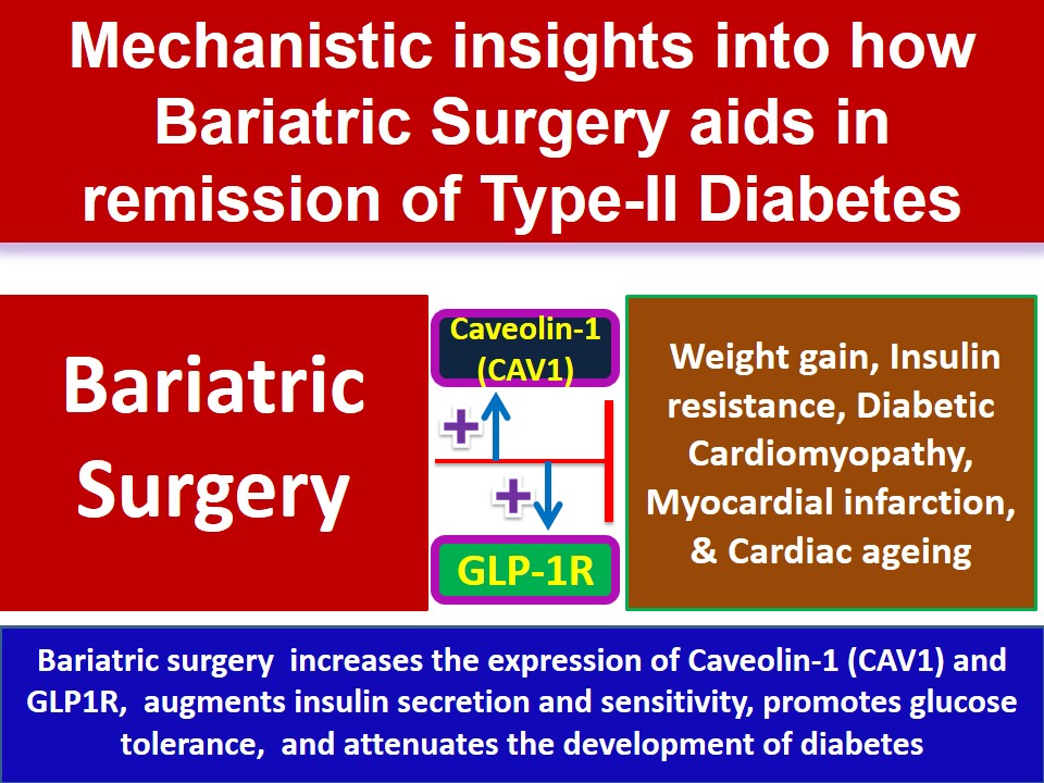 Alleviating Diabetes with Bariatric surgery: Bariatric surgery ...