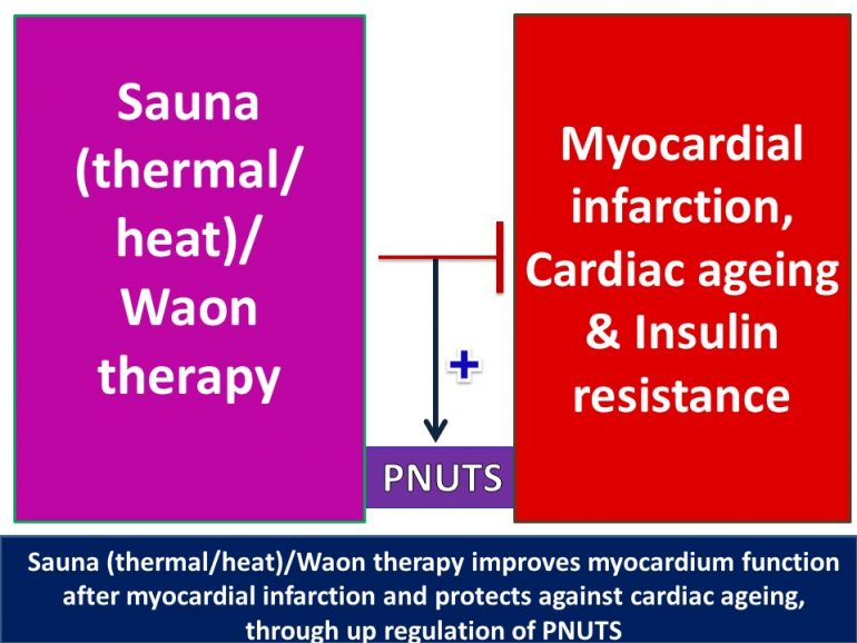 Sauna/Waon based regenerative cardiovascular therapy: Molecular ...